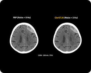 Medical Imaging Solution | Claripi