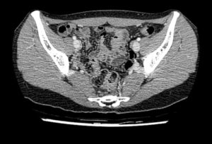 Medical Imaging Solution | Claripi