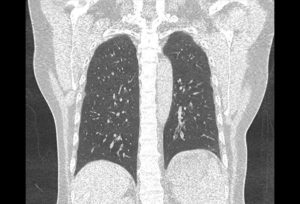 Medical Imaging Solution | Claripi