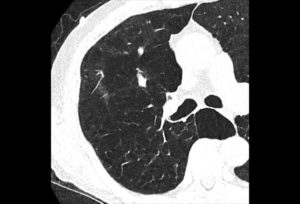Medical Imaging Solution | Claripi