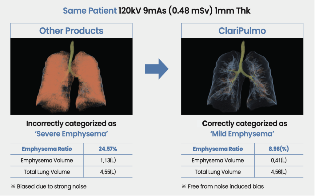 ClariPulmo | Fully Automated AI-Powered 3D Reporting Solution for ...