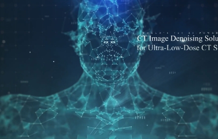 Proven performance of domestic AI low-dose CT technology - claripi