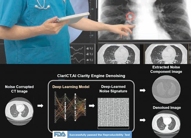Artificial intelligence medical imaging solution - claripi