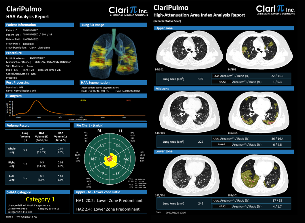ClariPulmo | AI-Powered 3D Reporting Solution for LDCT Lung Images