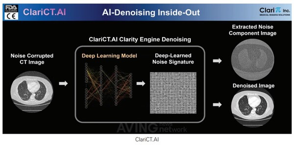 Announces AI-based ultra-low dose CT solution to ‘minimize medical ...